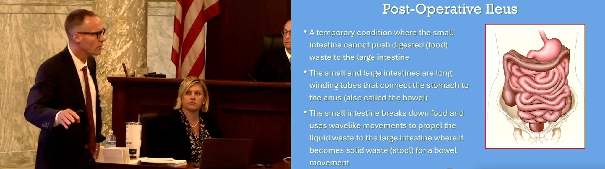 $75M Malpractice Trial Over Death Following Hernia Repair Begins: Watch ...