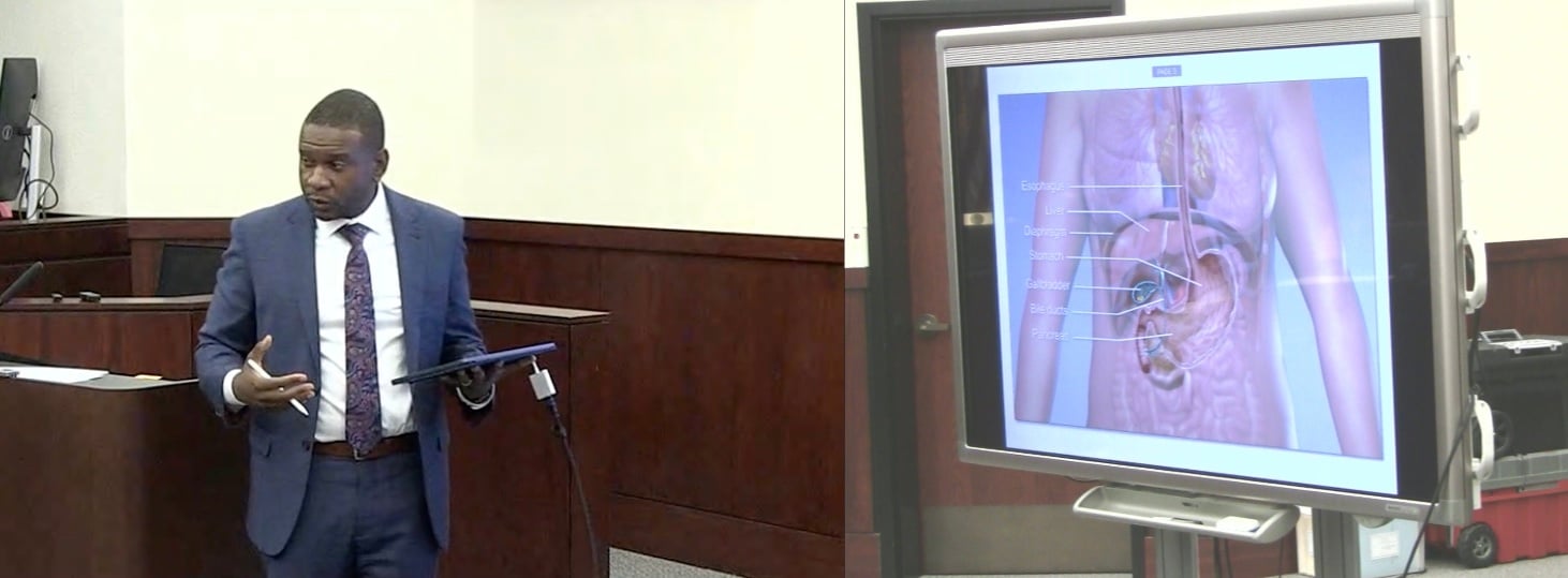 Florida Widower Seeks $9M At Med Mal Trial For Wife’s Endoscopy Death ...